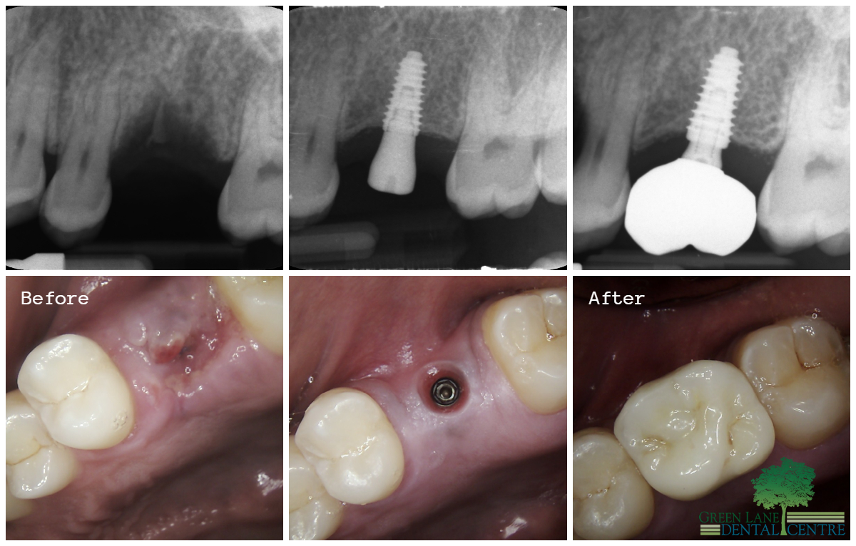Smile Gallery - Ardent Sidcup Dental Clinic | NHS and Private