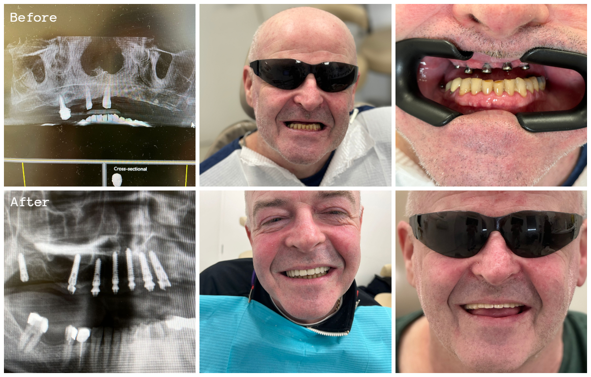 Smile Gallery - Ardent Sidcup Dental Clinic | NHS and Private