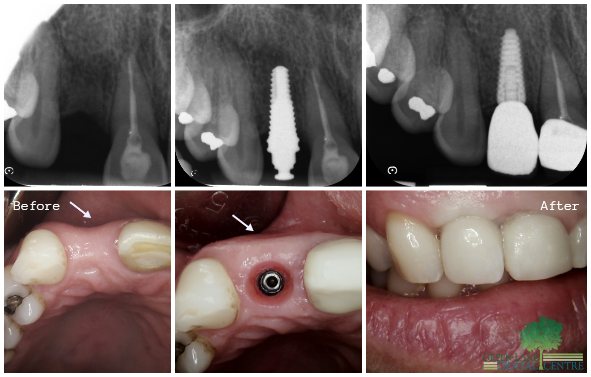 Smile Gallery - Ardent Sidcup Dental Clinic | NHS and Private