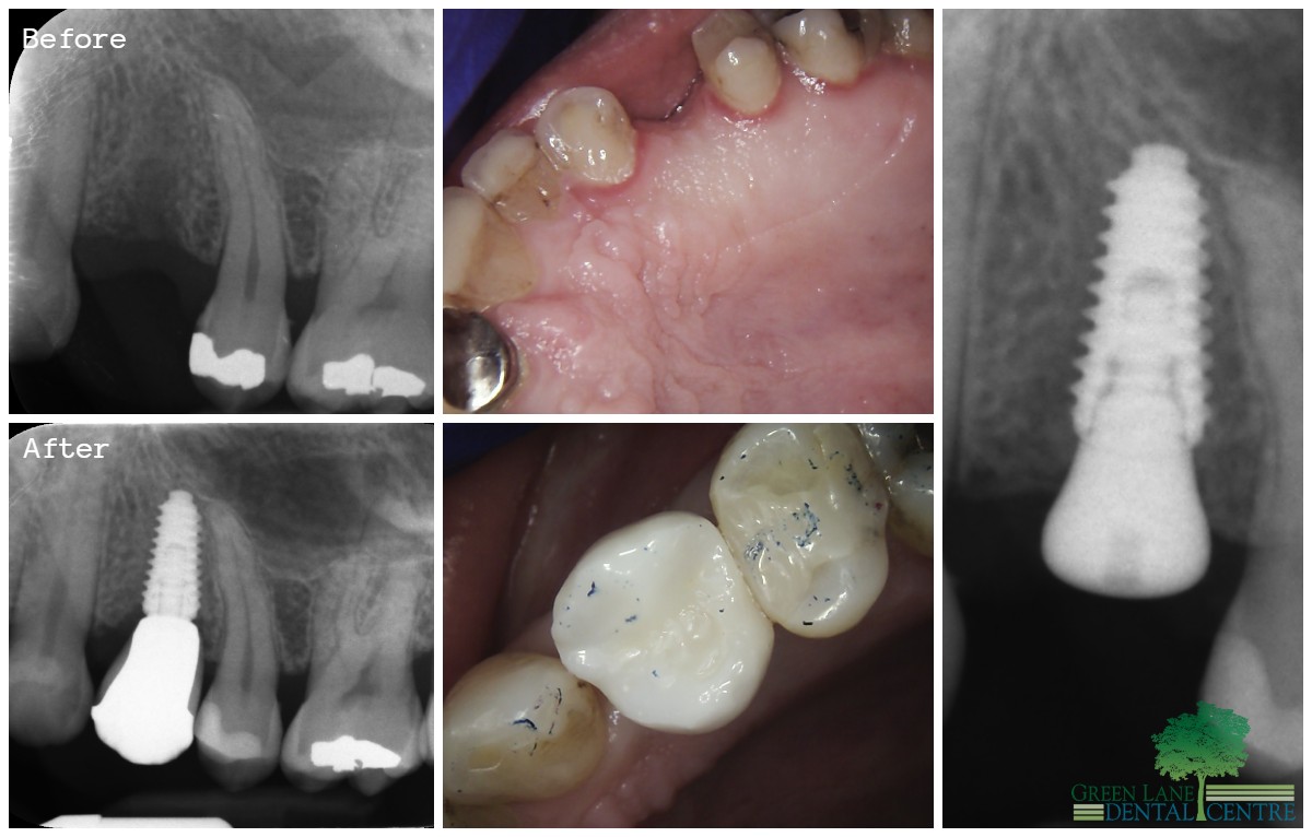 Smile Gallery - Ardent Sidcup Dental Clinic | NHS and Private