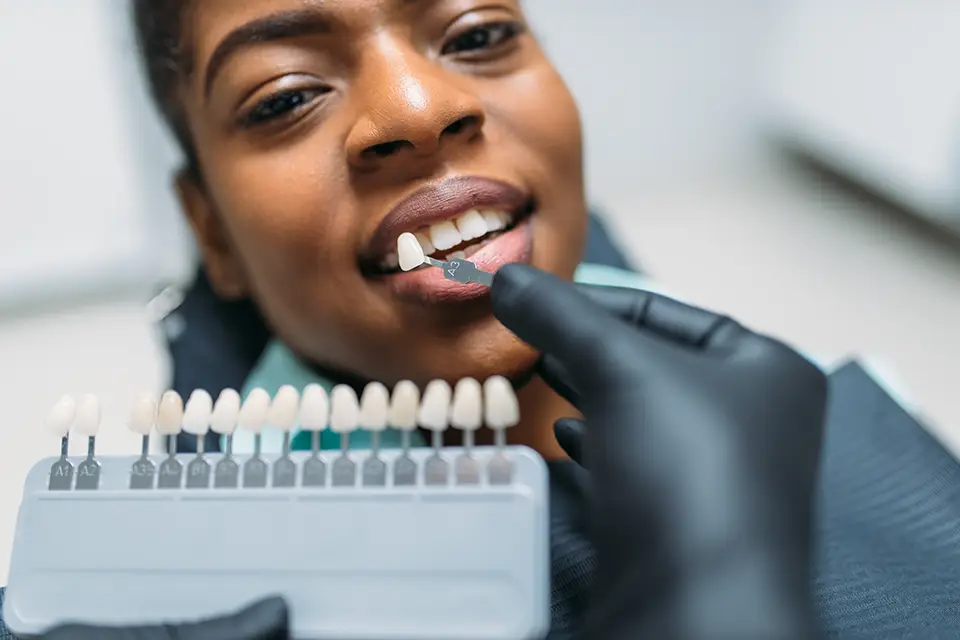 What Are Acrylic Veneers? Pros & Cons + Cost in Sidcup